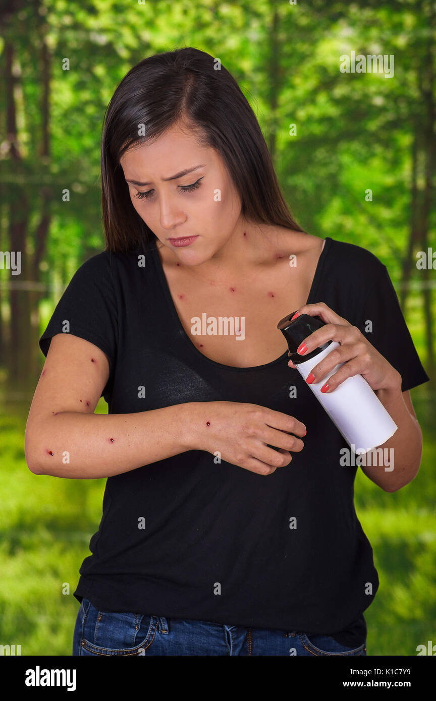 Mosquito Bites On Black Skin