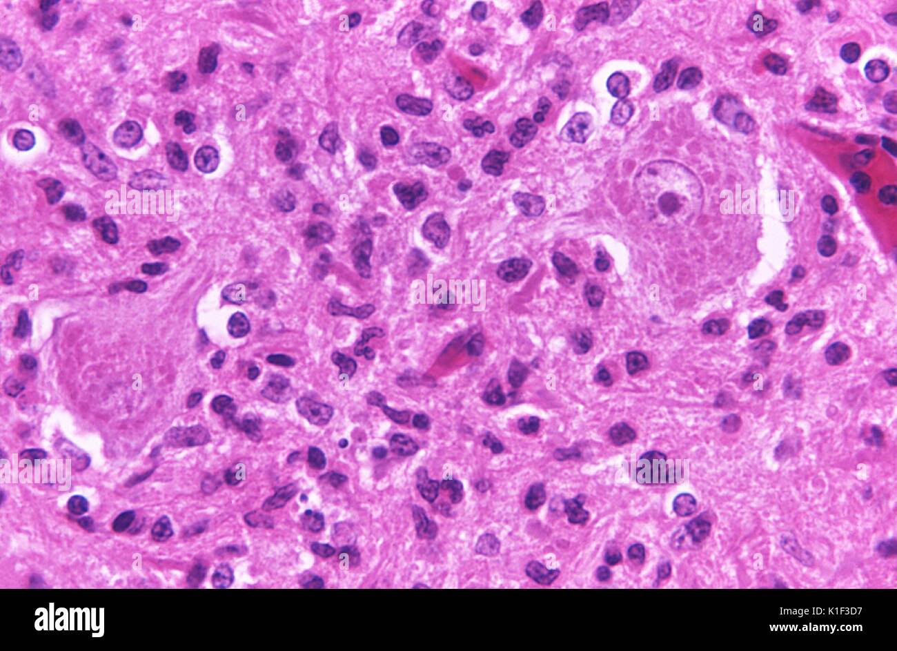 Photomicrograph of hematoxylin-eosin (HandE) stained brain tissue from ... Photomicrograph of hematoxylin-eosin (HandE) stained brain tissue from ...