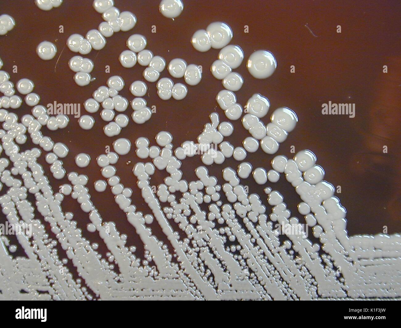 Burkholderia pseudomallei grown on sheep blood agar for 96 hours ...