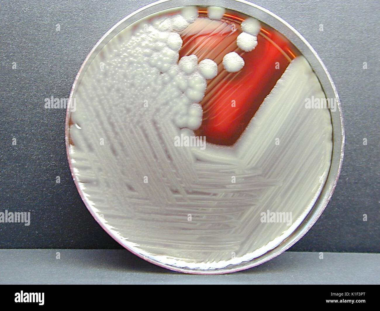 Bacillus cereus showing hemolysis on sheep blood agar. B. cereus is a ...
