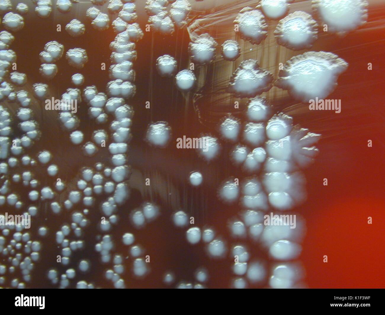 Yersinia Pestis Blood Agar