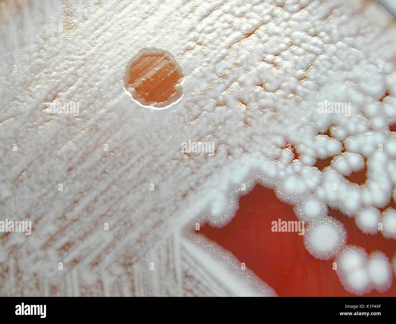 Bacillus anthracis gamma phage lysis on sheep blood agar. Bacillus ...