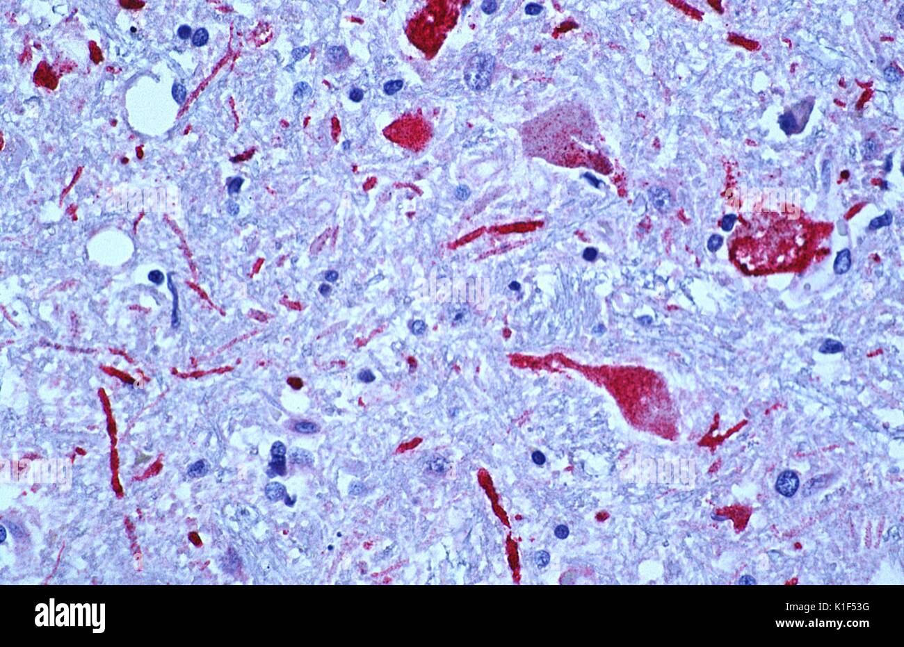 Antigen positive neurons hi-res stock photography and images - Alamy