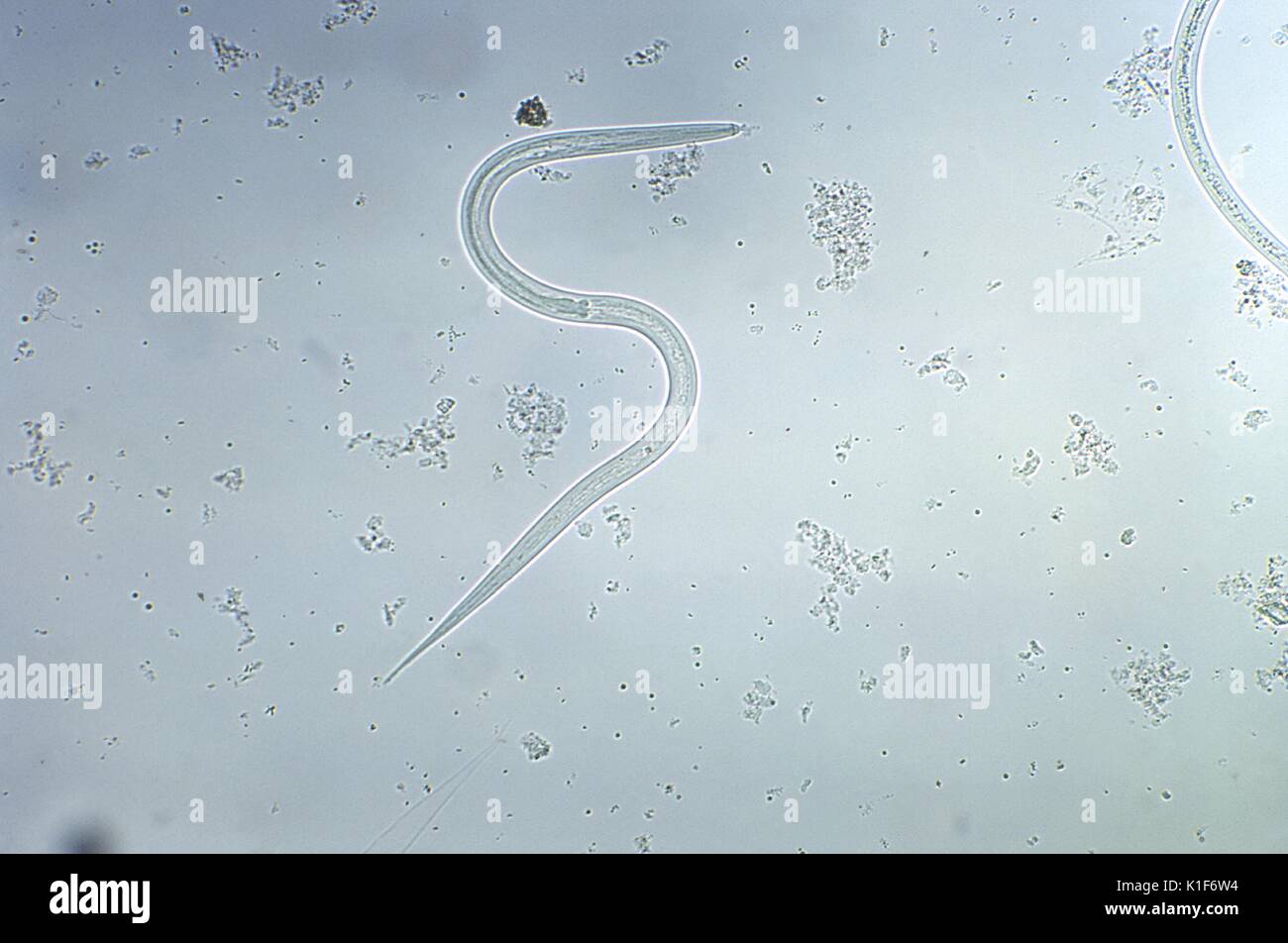 Stercoralis hi-res stock photography and images - Alamy