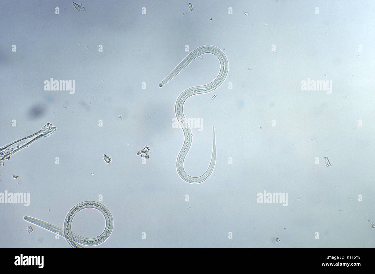 Strongyloides stercoralis hi-res stock photography and images - Alamy