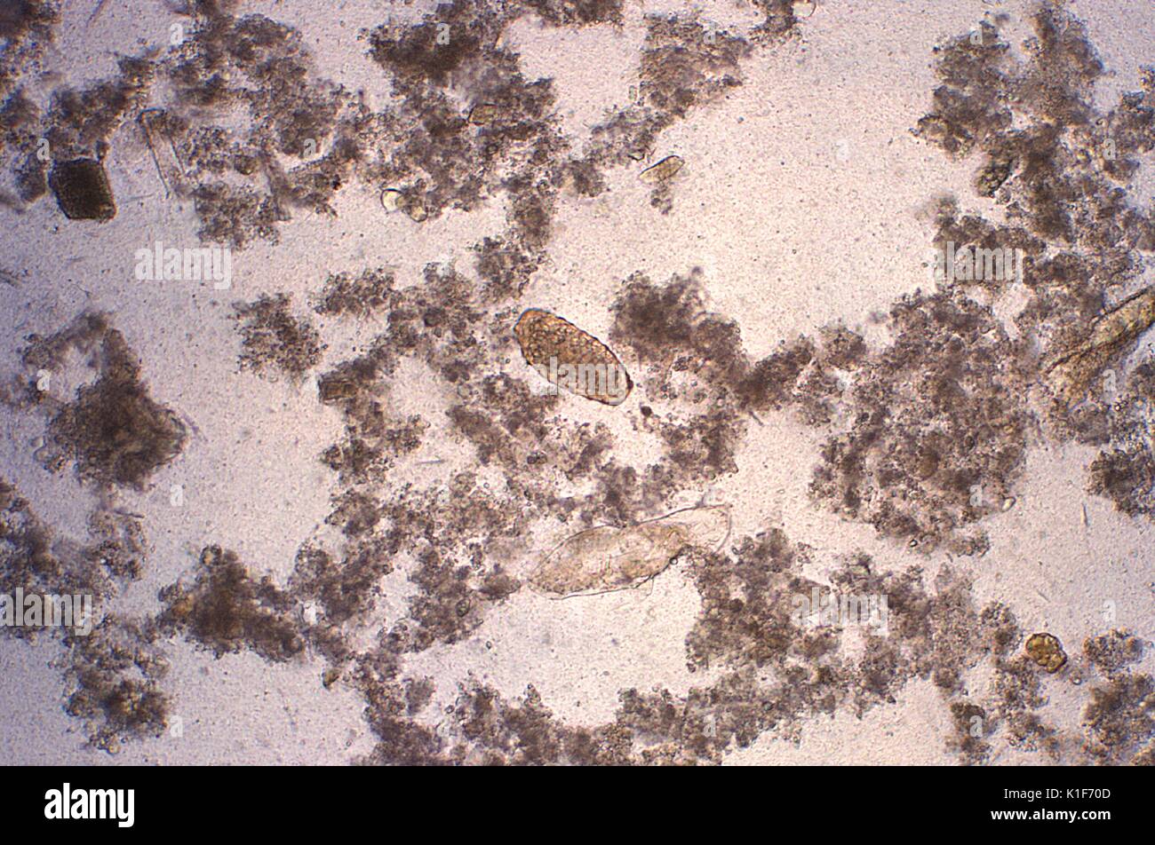 Magnified 128X, this photomicrograph revealed some of the ...