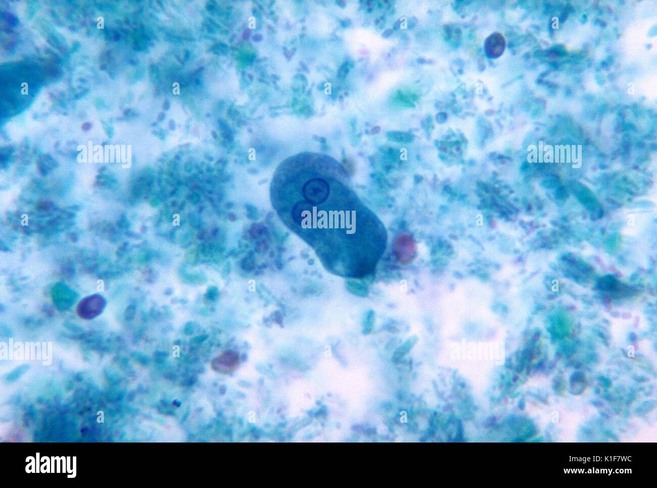 This micrograph revealed a trophozoite of an Entamoeba histolytica ...