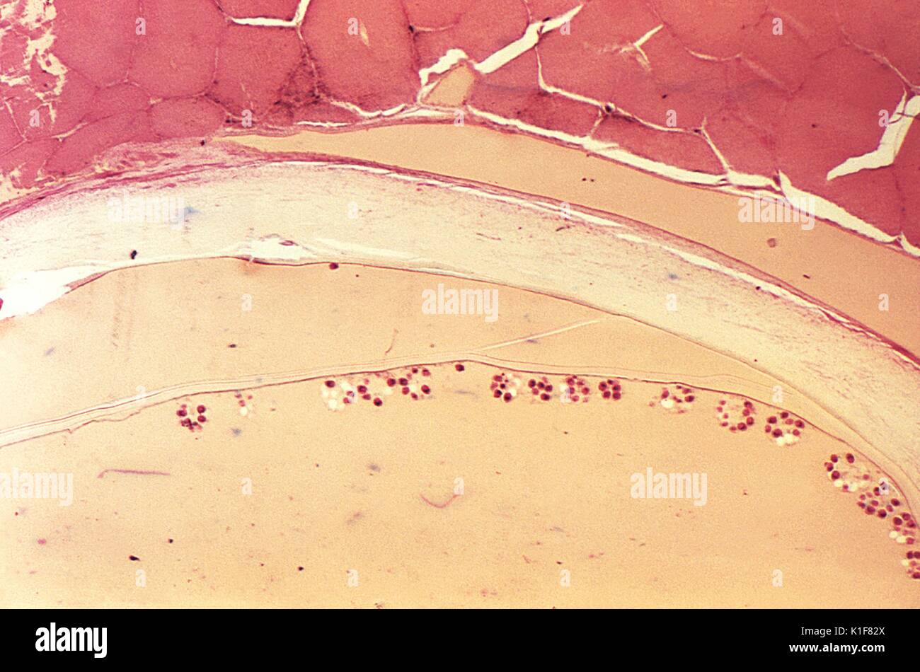 Echinococcus sp hi-res stock photography and images - Alamy