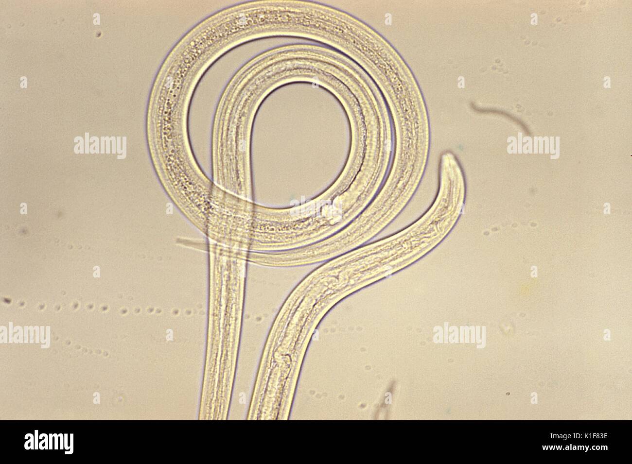 Magnified 400X, this photomicrograph depicted a number of Strongyloides ...