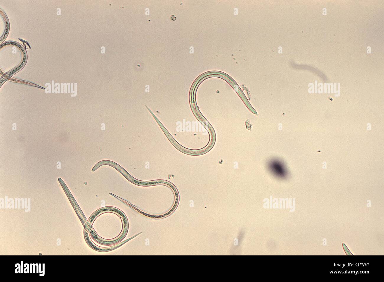 Strongyloides sp filariform hi-res stock photography and images - Alamy