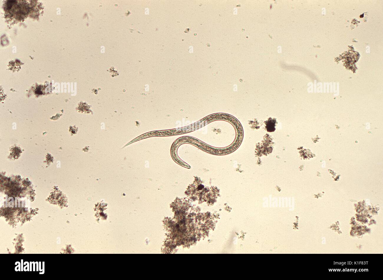 Hookworm Stock Photos & Hookworm Stock Images - Alamy