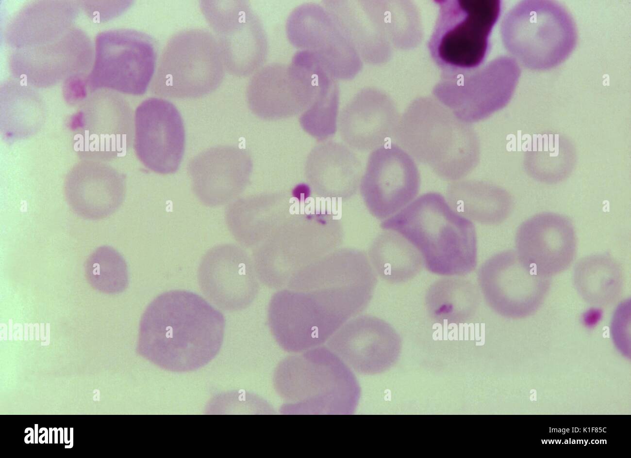 This blood smear micrograph reveals a Babesia sp. tetrad formation ...