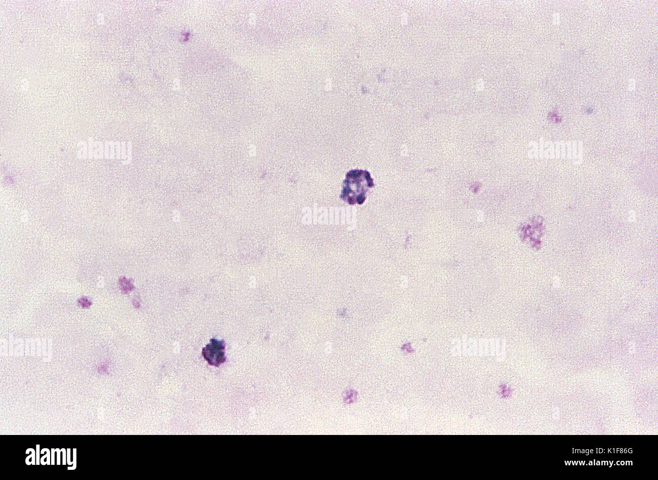 This Giemsa stained thick film micrograph depicts an immature P ...