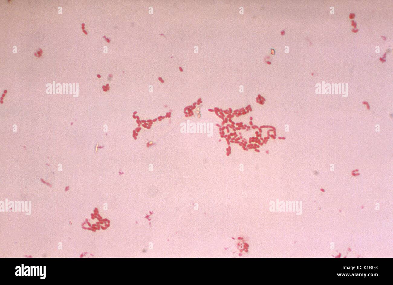 Acinetobacter hi-res stock photography and images - Alamy Acinetobacter hi-res stock photography and images - Alamy