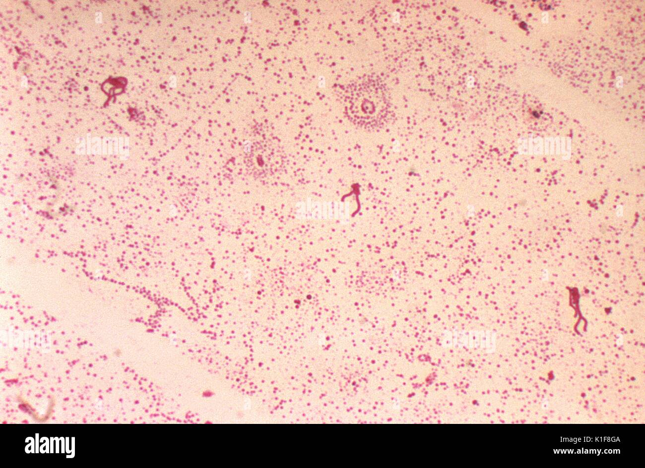 Alcaligenes denitrificans . Flagella stain. Image courtesy CDC/Dr. W.A ...