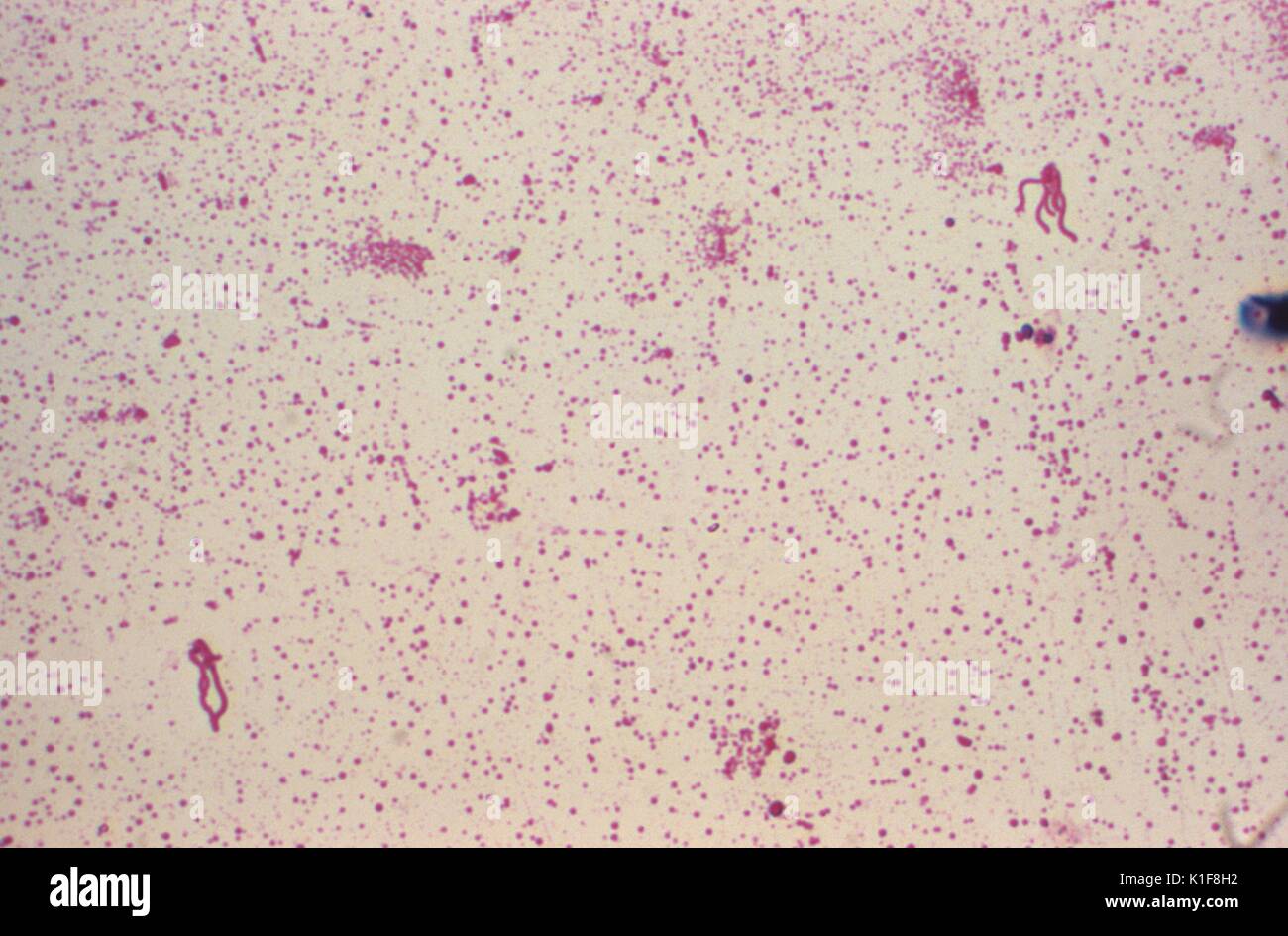 Alcaligenes Faecalis Slant