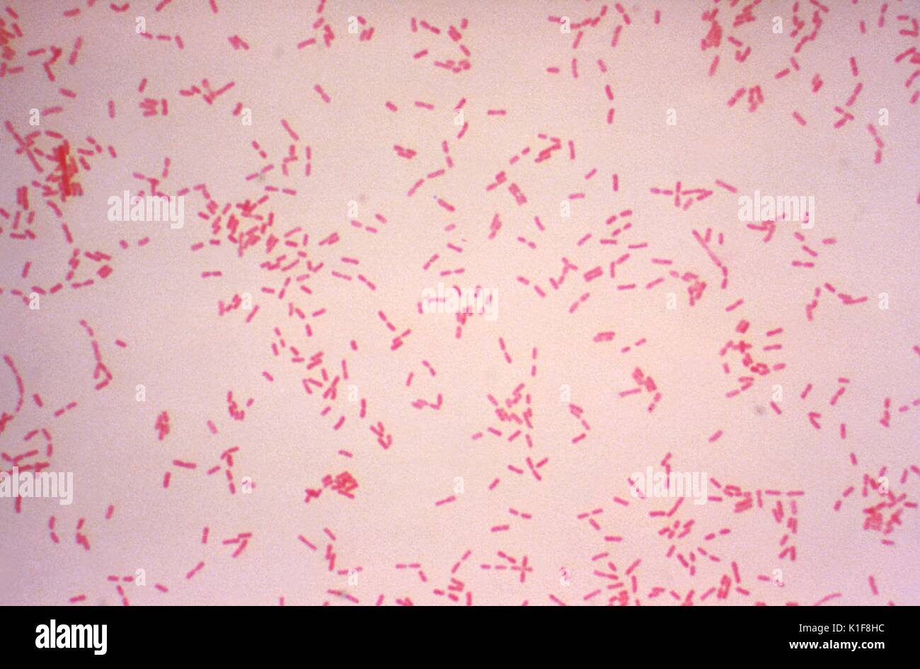 Alcaligenes Faecalis On Emb