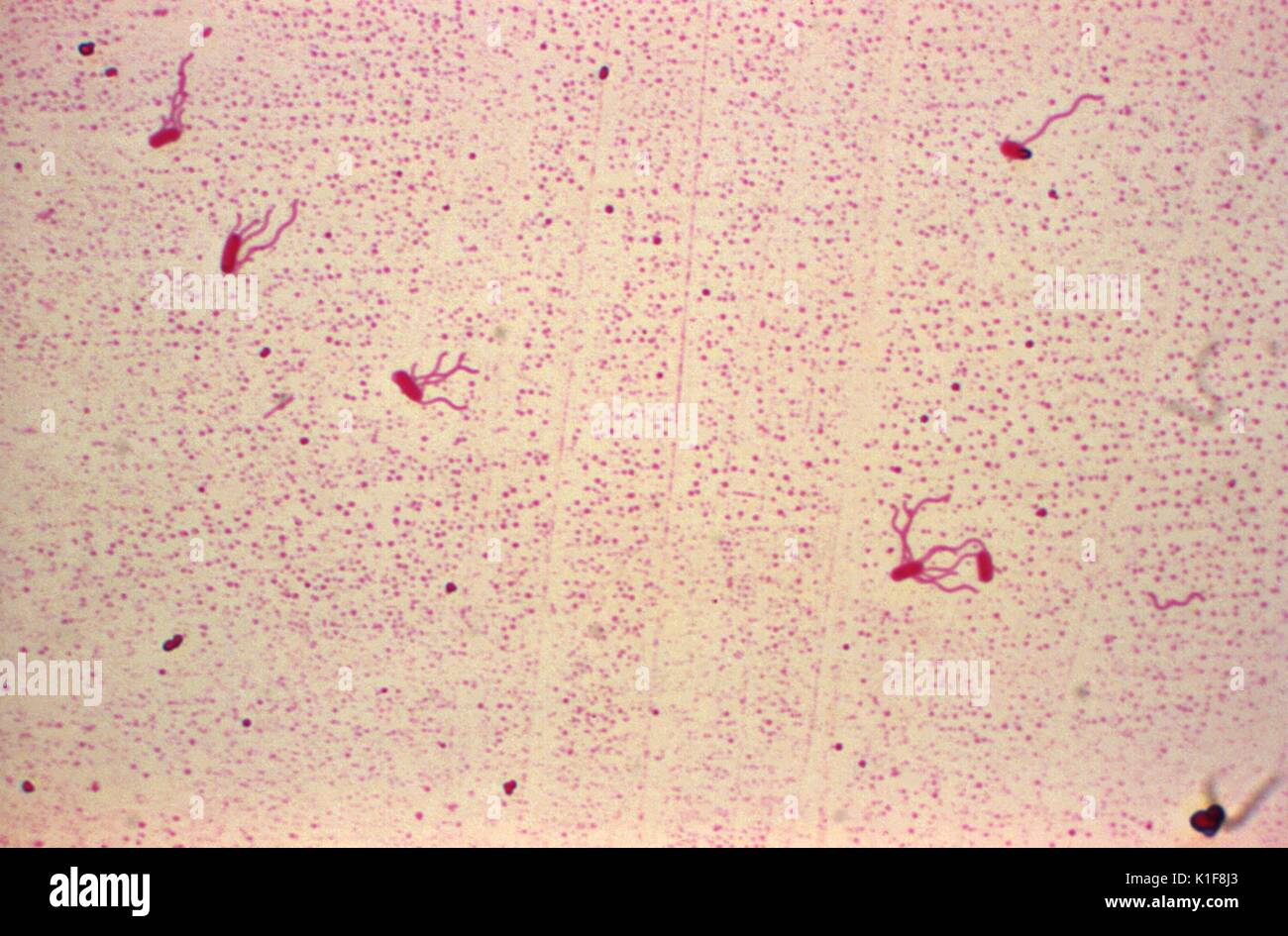 Alcaligenes Faecalis Gram Stain