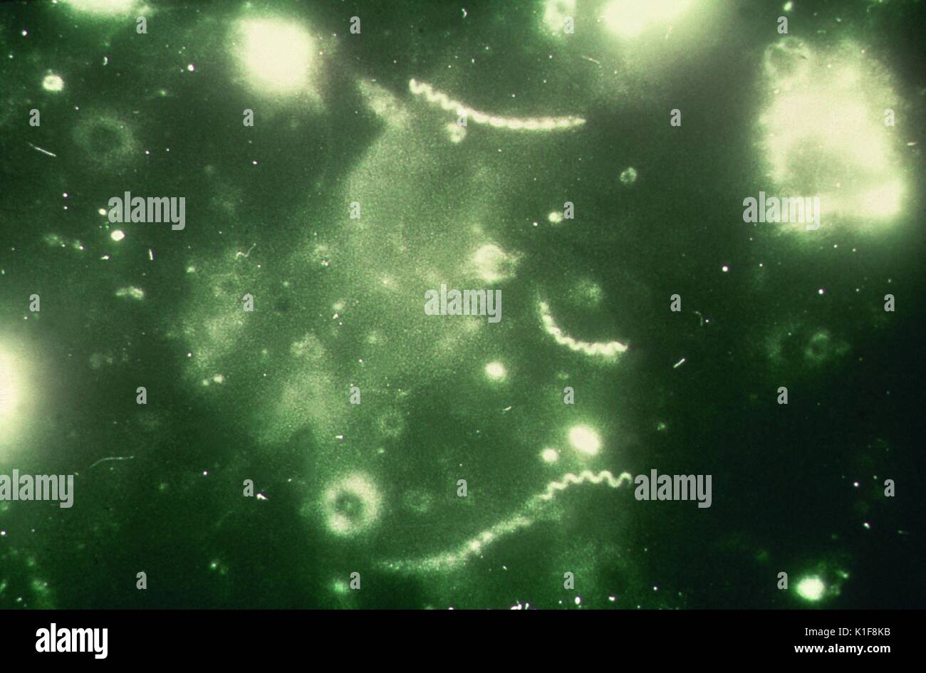 Treponema pallidum dark High Resolution Stock Photography and Images ...