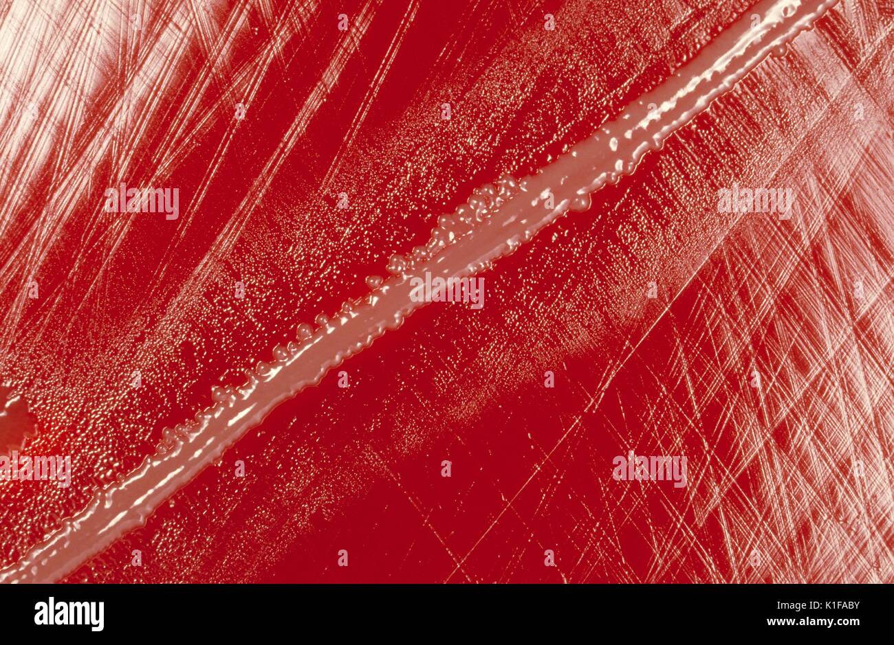 Haemophilus influenzae satelliting around Staphylococcus aureus, Blood ...