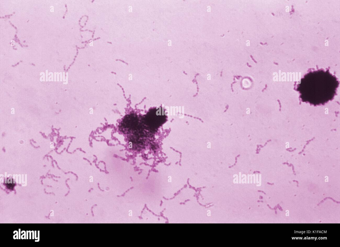 Streptococcus Gram Stain