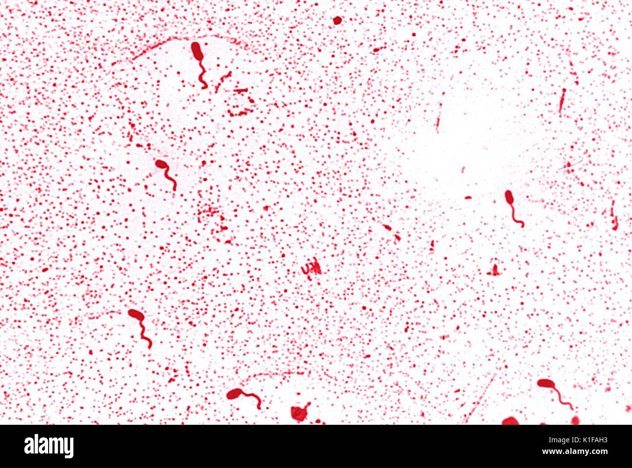 Vibrio cholerae Leifson flagella stain (digitally colorized) Image ...