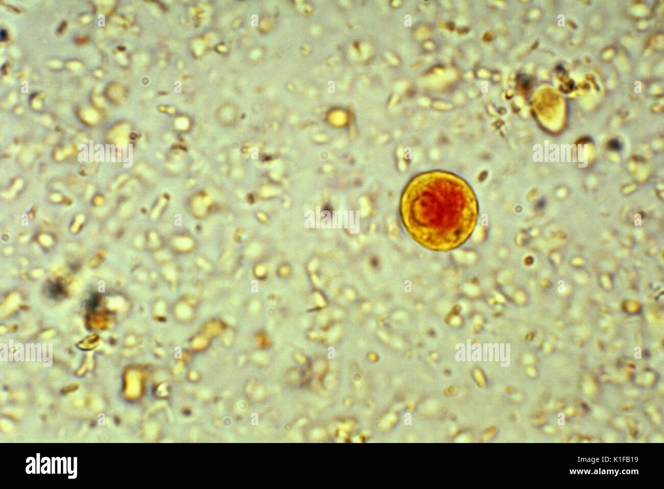Entamoeba Coli Trofozoito