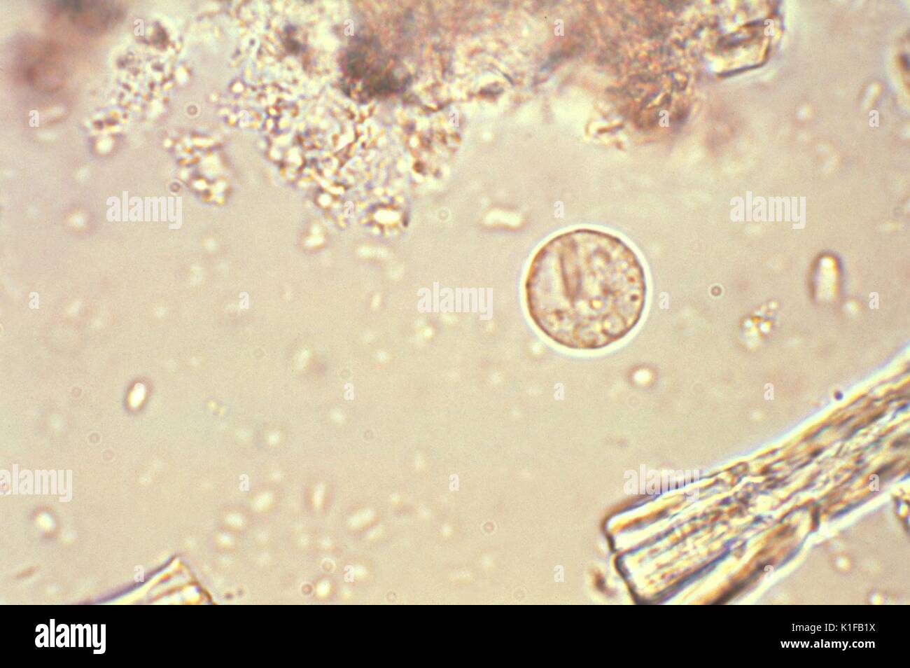 Entamoeba Histolytica Trophozoite In Stool
