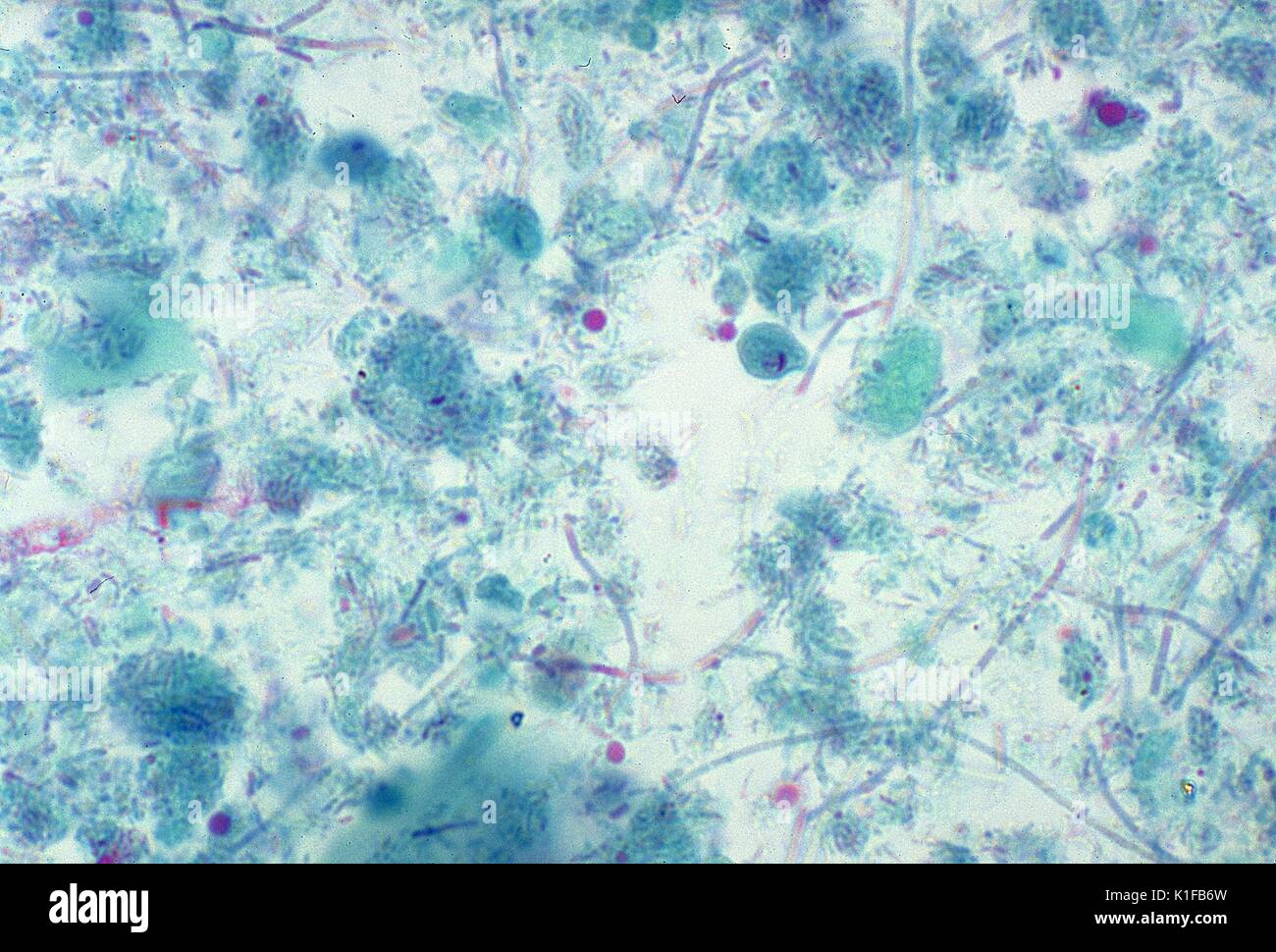 This photomicrograph depicts the cyst of an Chilomastix mesnili ...