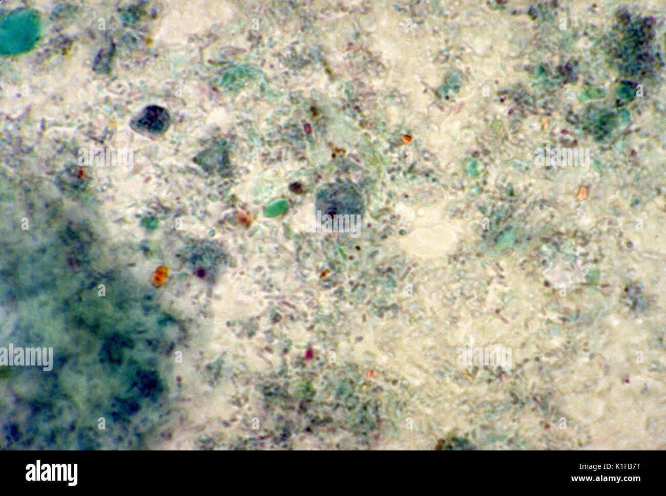 Trophozoite hi-res stock photography and images - Alamy