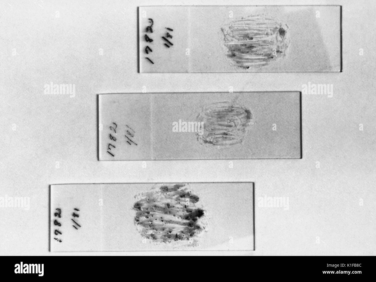 Fecal smear technique hi-res stock photography and images - Alamy