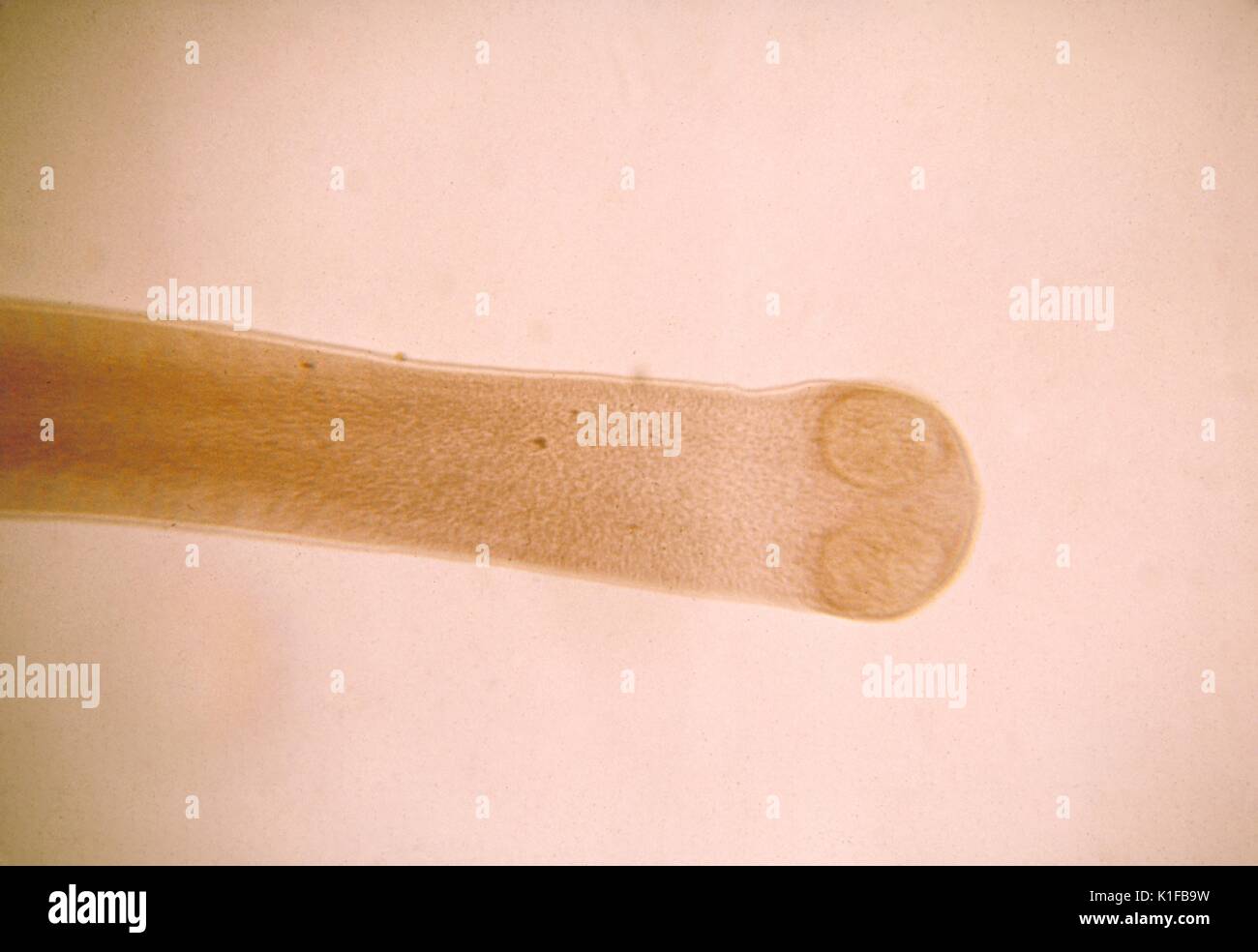 Scolex hi-res stock photography and images - Alamy