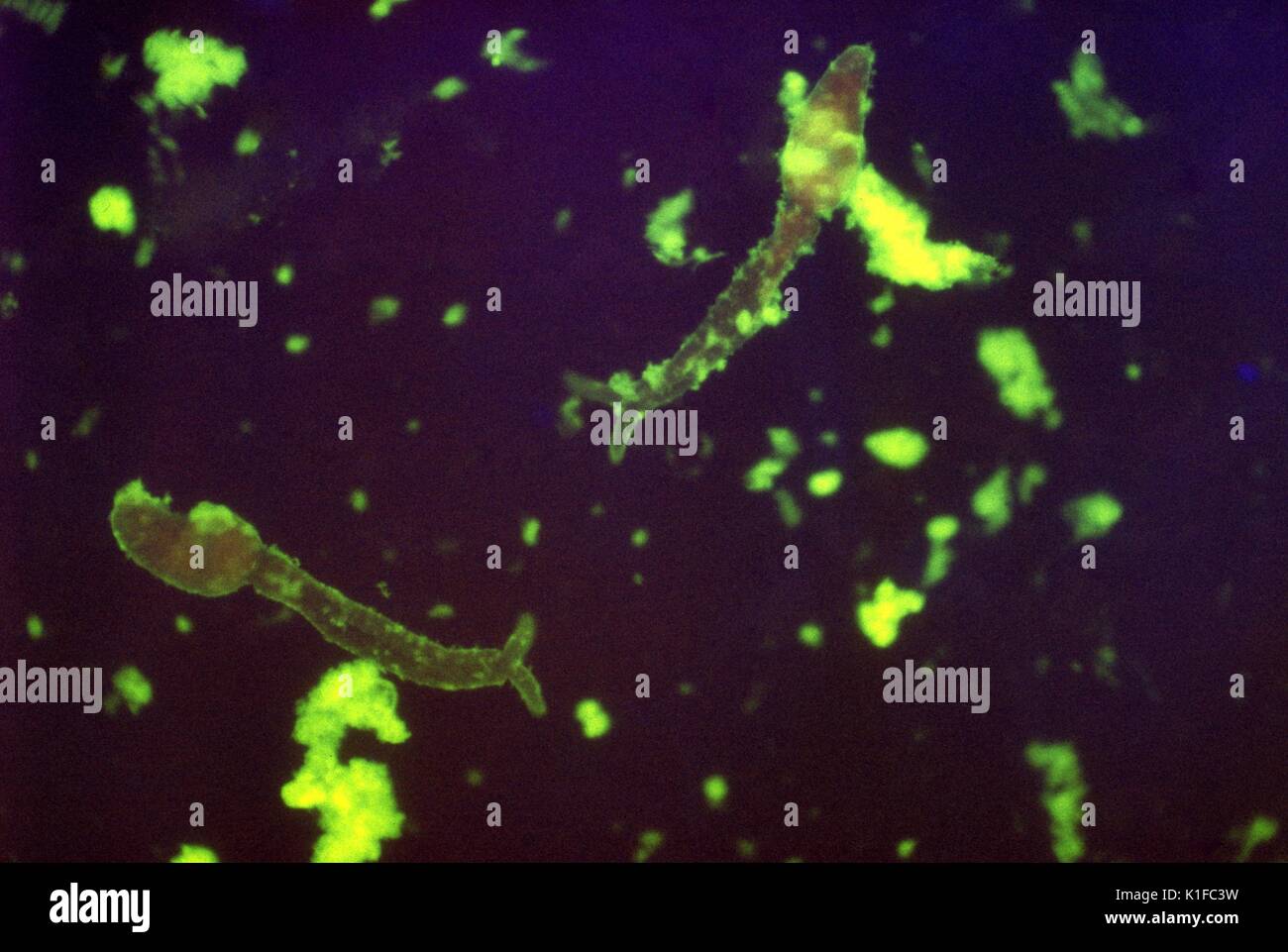 Cercariae of Schistosoma mansoni . Indirect fluorescent antibody stain ...
