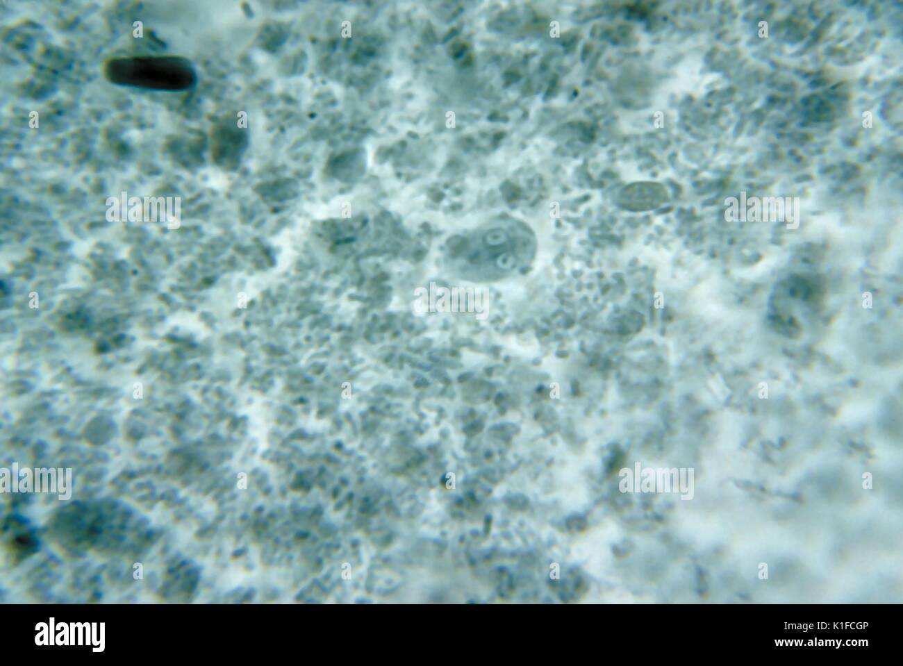 Giardia lamblia trophozoite. Chlorazol black stain. Parasite. Image ...