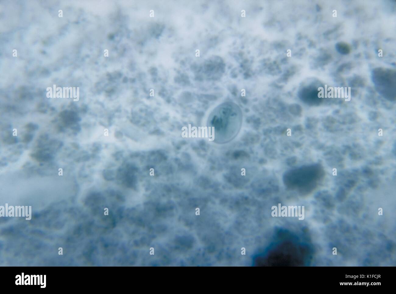 Giardia lamblia cyst. Chlorazol black stain. Parasite. Image courtesy ...