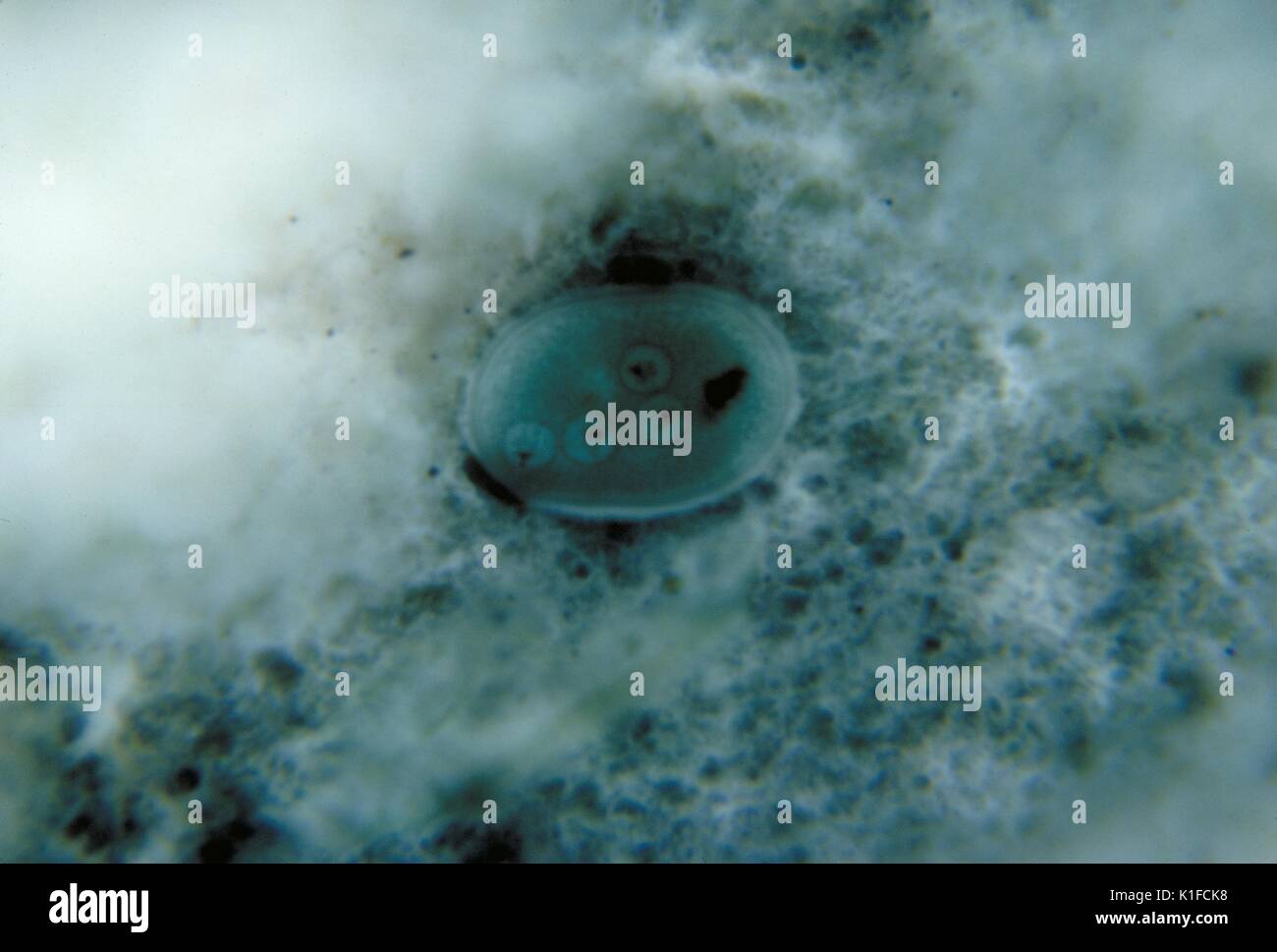 Entamoeba coli cyst. Chlorazol black stain. Parasite, ameba. Image ...