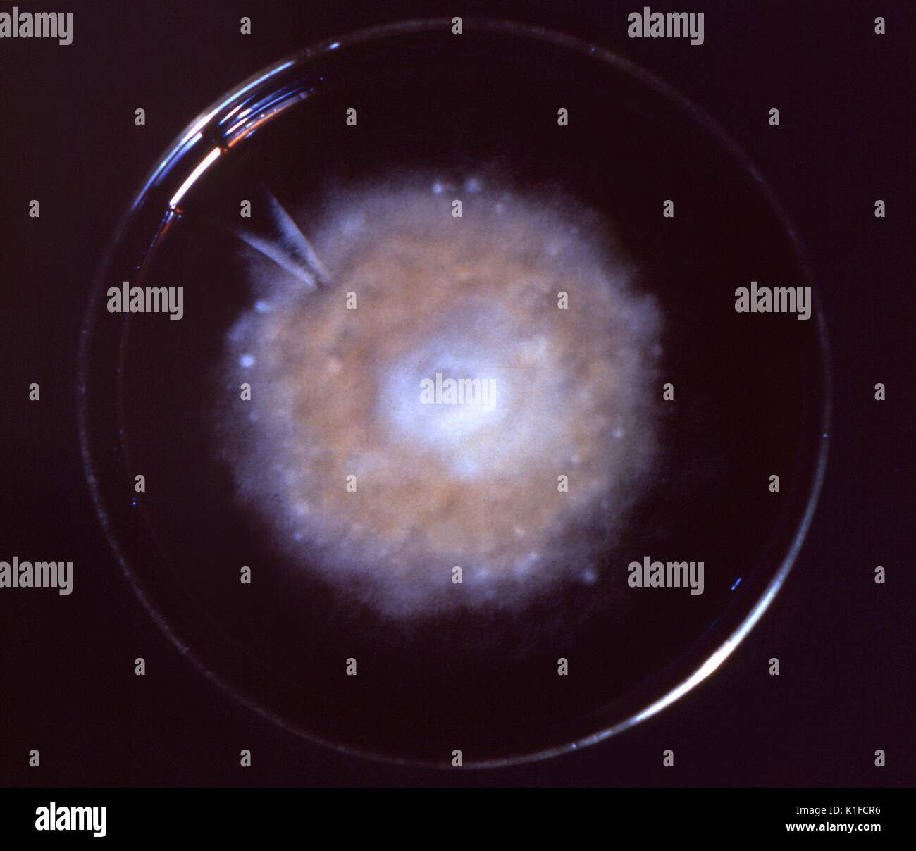 Histoplasmosis micrograph hi-res stock photography and images - Alamy