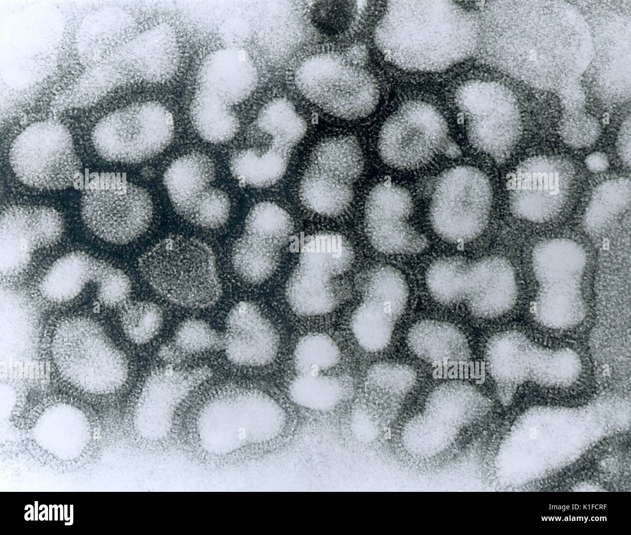 This transmission electron micrograph (TEM) depicts numbers of ...
