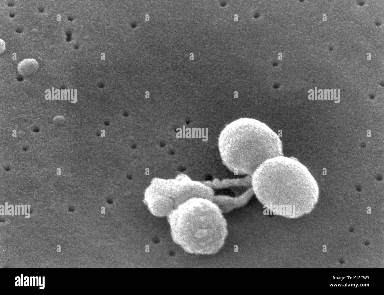 Scanning electron micrograph (SEM) of a number of Gram-positive Streptococcus pneumoniae ...