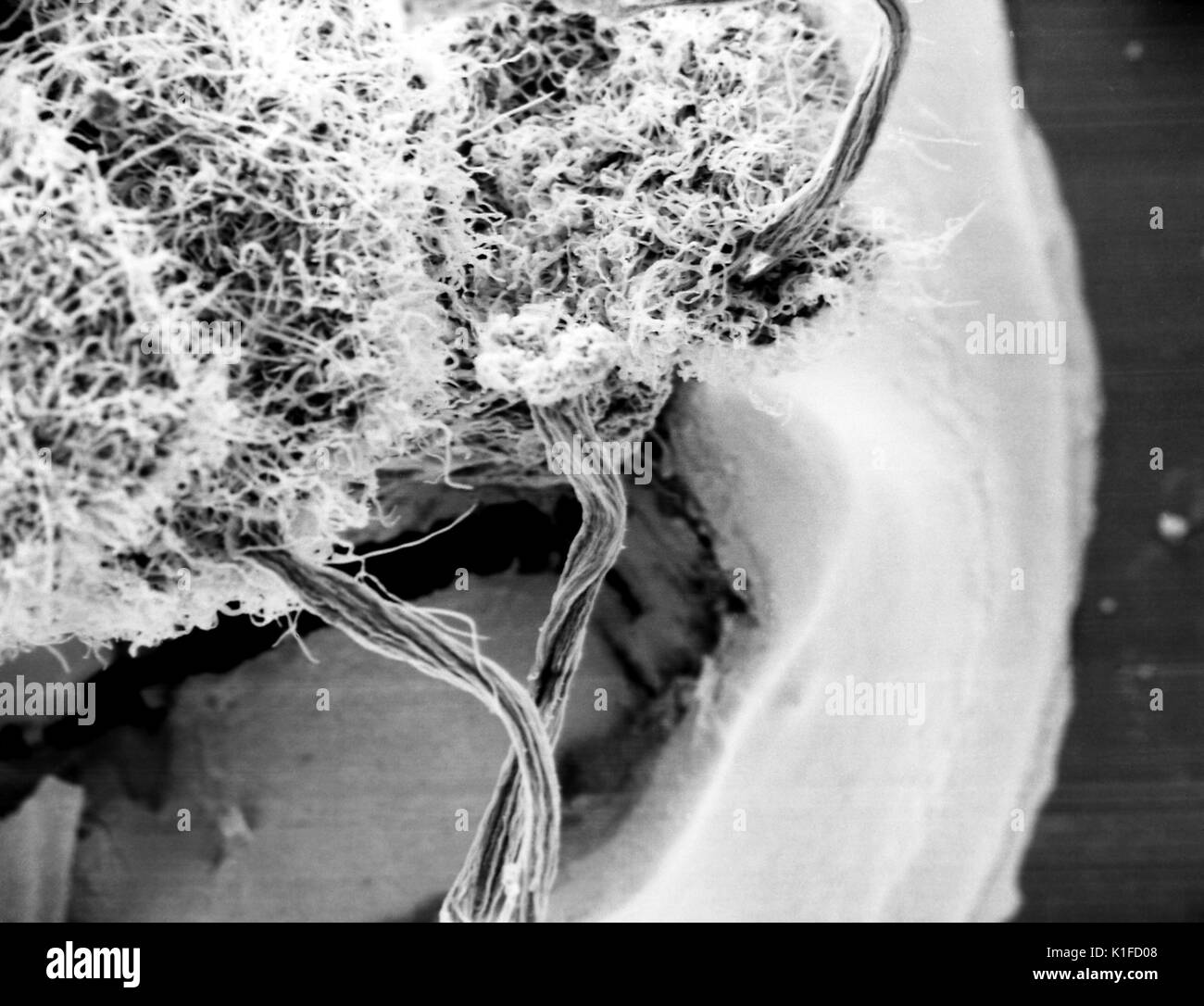 Red raspberry drupelet Black and White Stock Photos & Images - Alamy