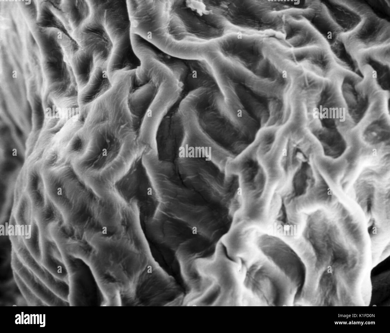 This electron micrograph reveals the textured surface of a blackberry ...