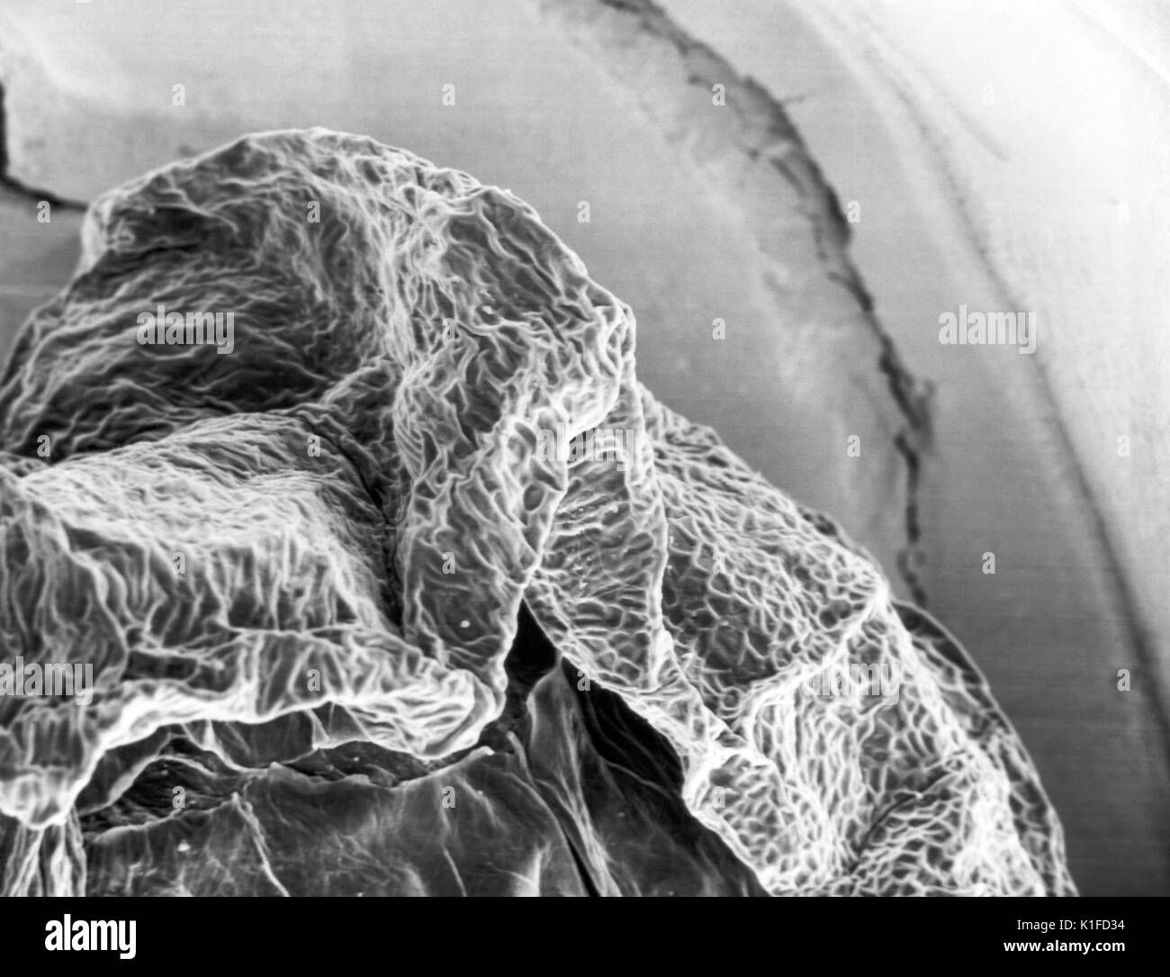 Image courtesy cdc Black and White Stock Photos & Images - Alamy