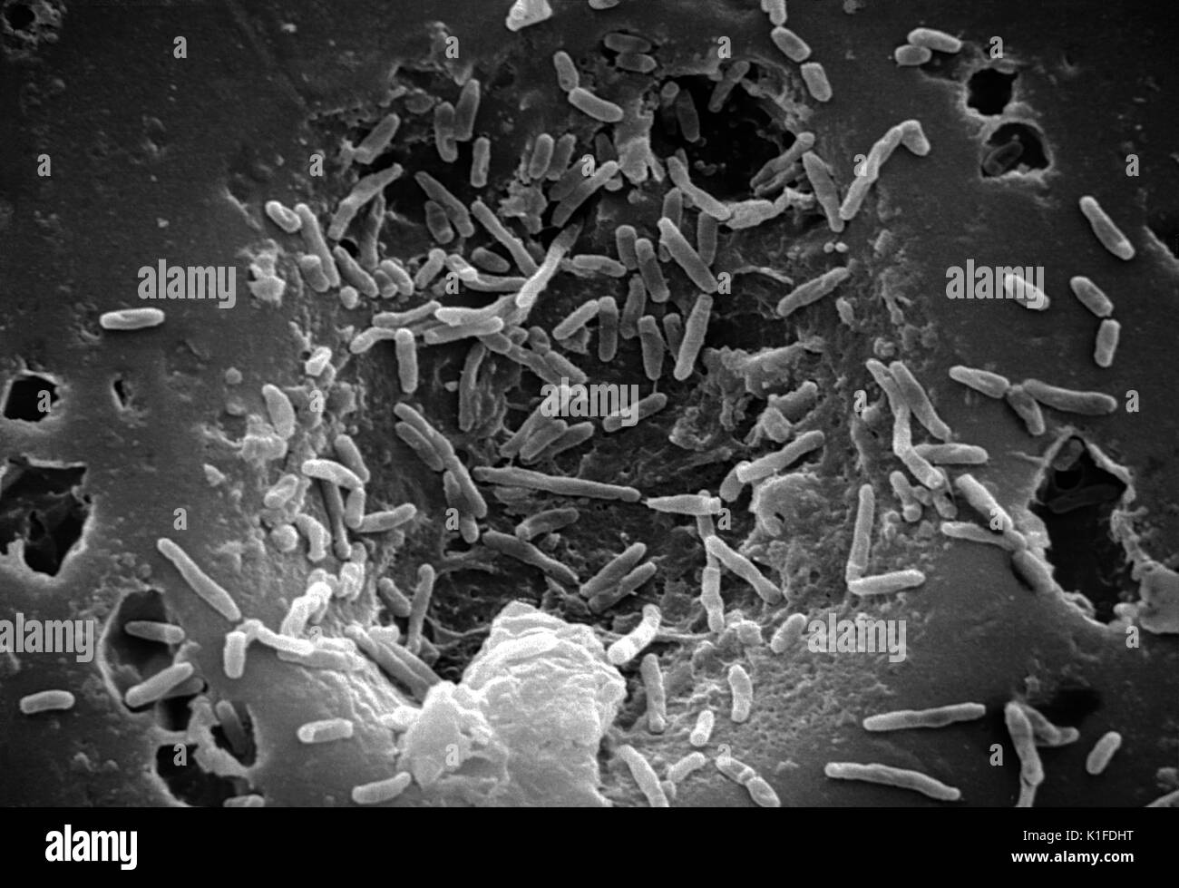 Mycobacterium Leprae Electron Micrograph