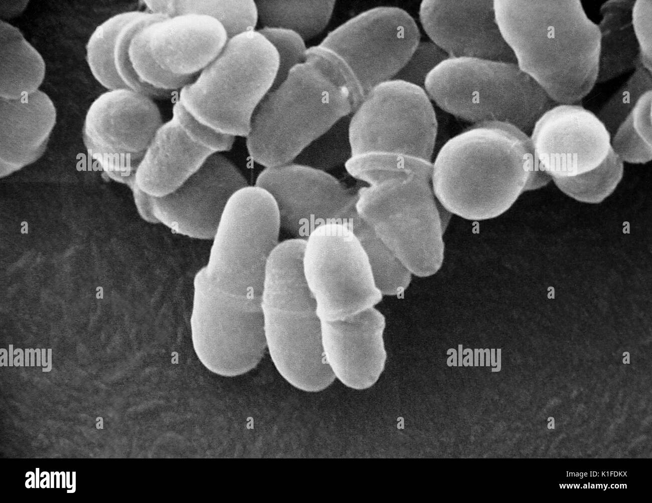 Scanning Electron Micrograph Sem Of Malassezia Lipophilis Image Courtesy Cdc 1984 Stock