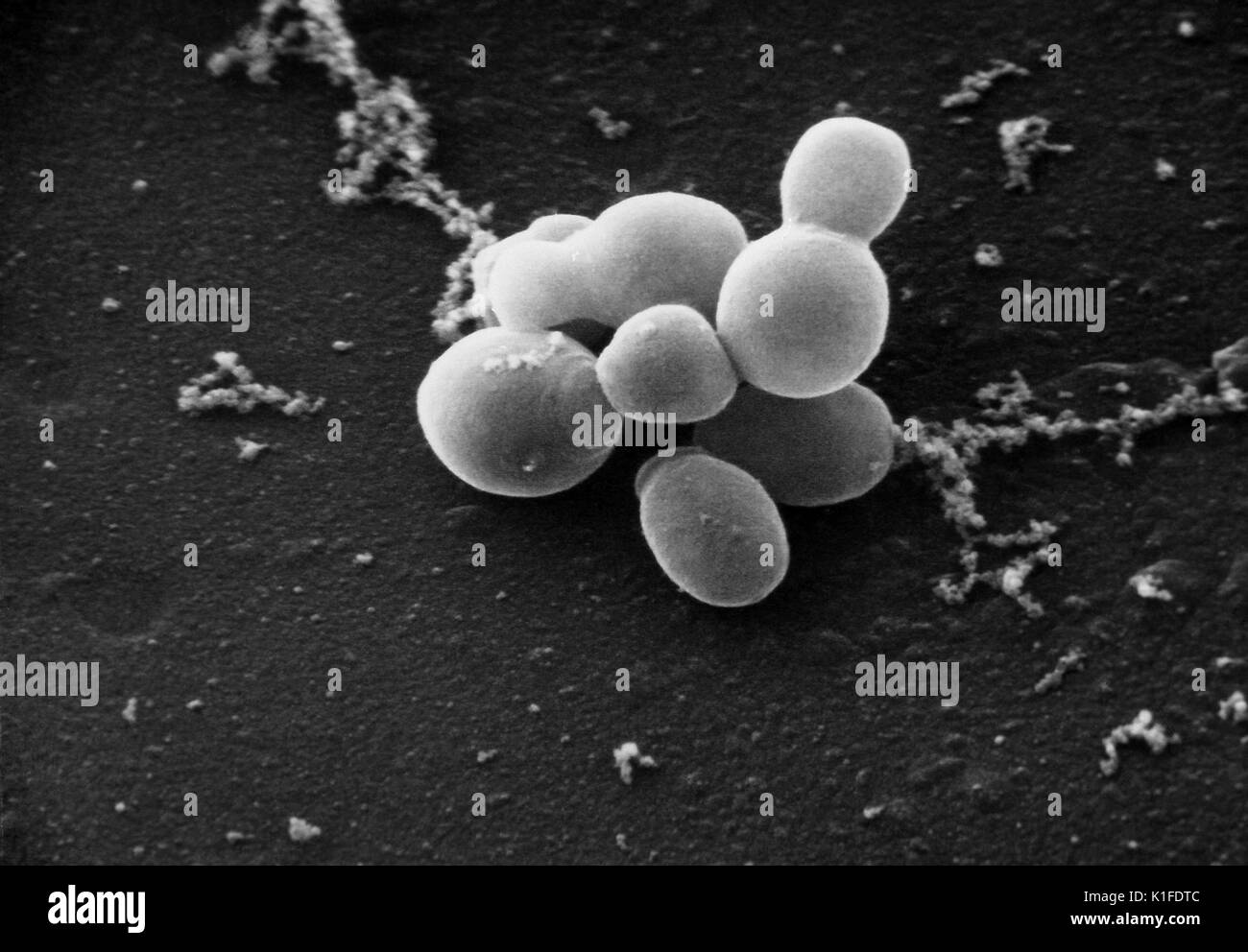 Fungus malassezia furfur hi-res stock photography and images - Alamy