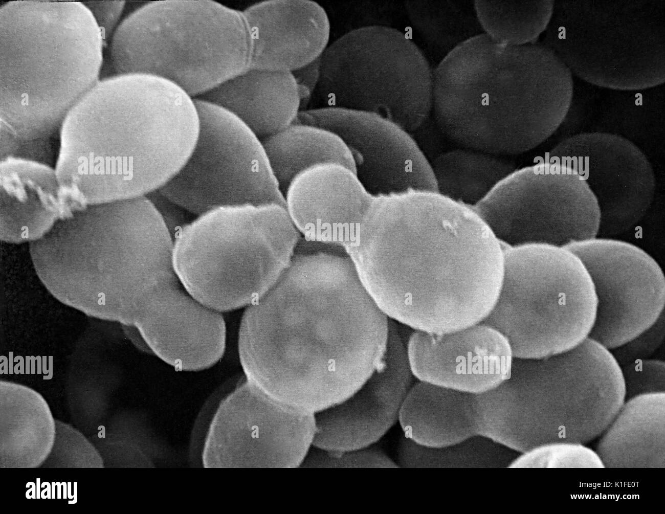 Scanning electron micrograph (SEM) of Malassezia furfur . Image ...