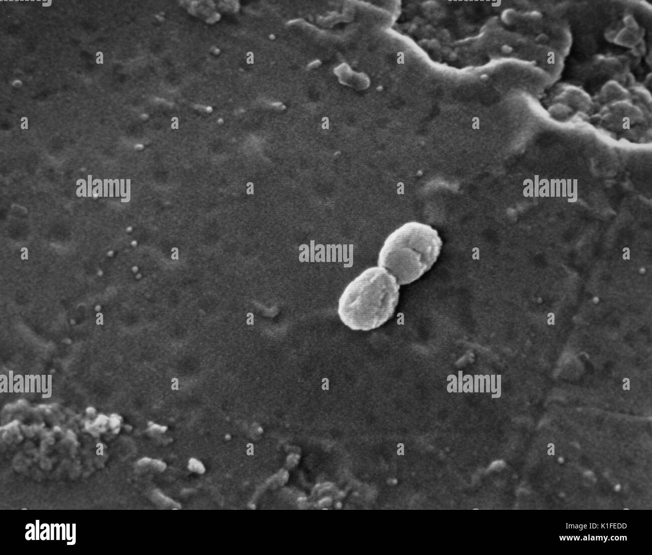 Acinetobacter anitratus hi-res stock photography and images - Alamy