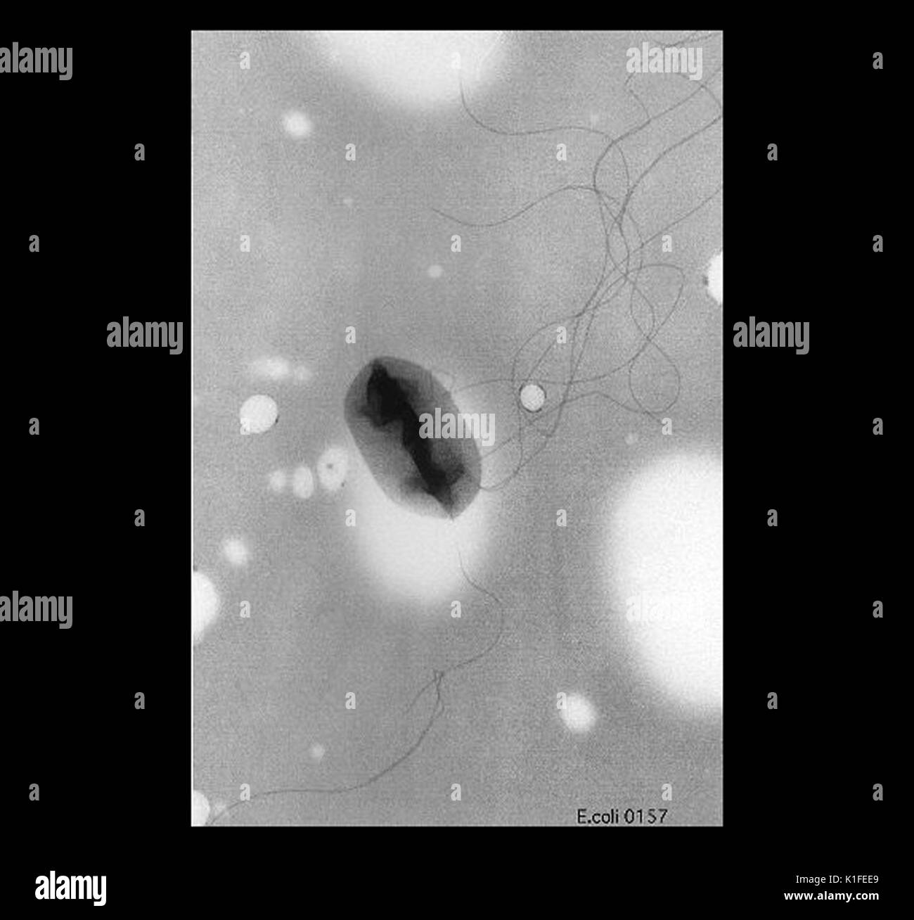 Escherichia coli o157 hi-res stock photography and images - Alamy