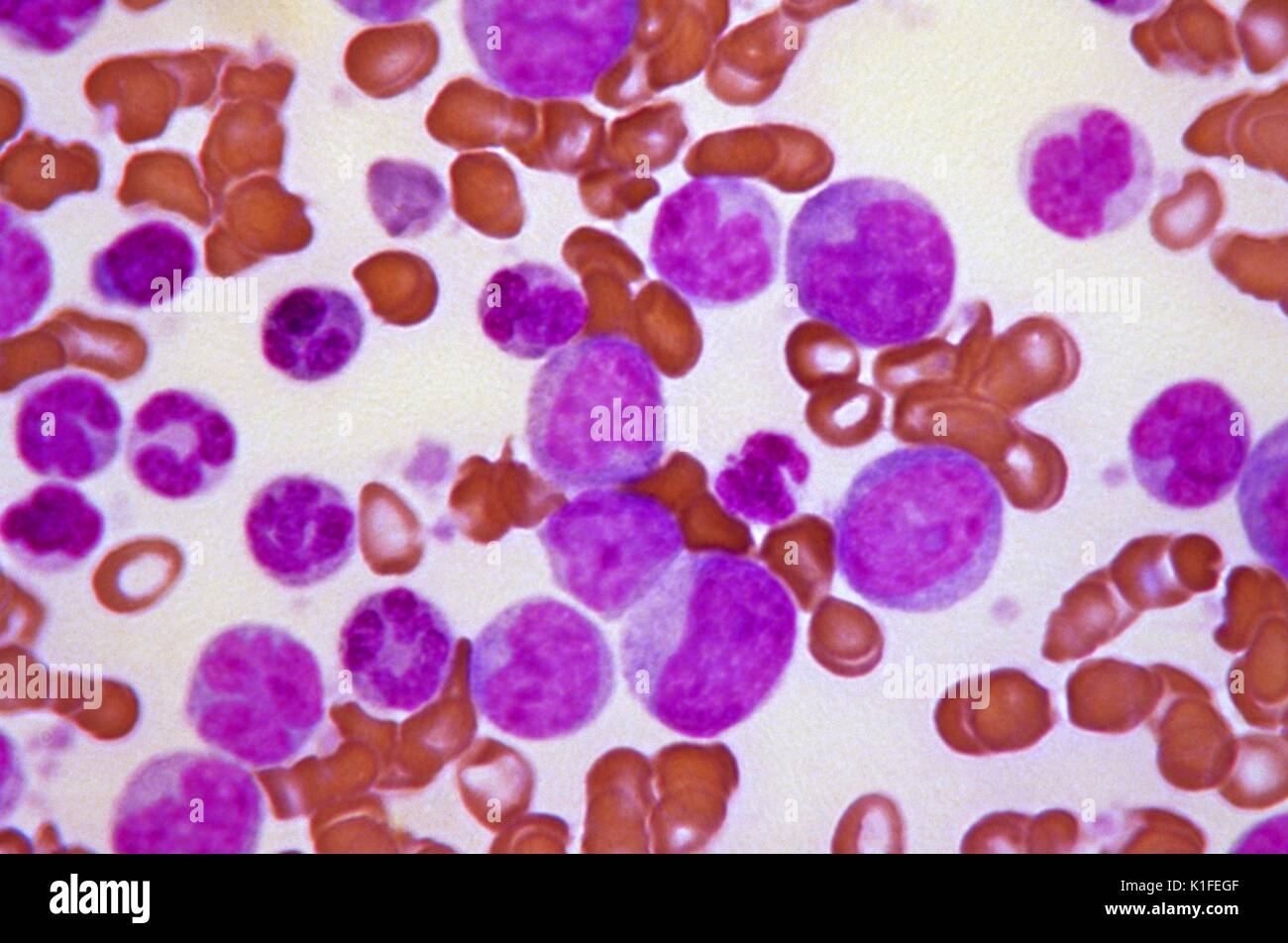 Cml hi-res stock photography and images - Alamy