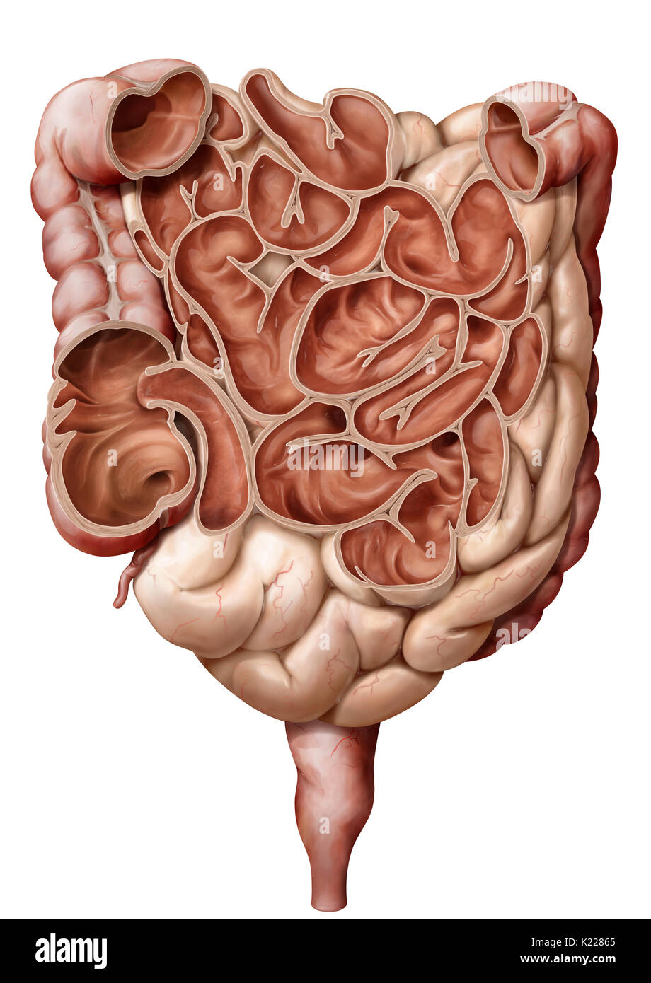 Small intestines hi-res stock photography and images - Alamy